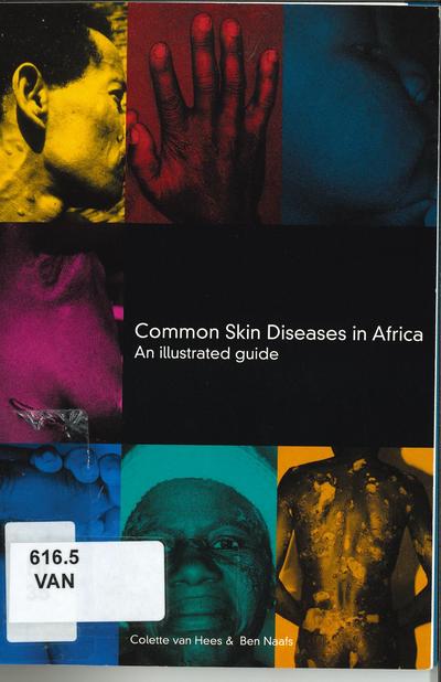 Common Skin Diseases in Africa: An illustrated Guide | ECHOcommunity.org